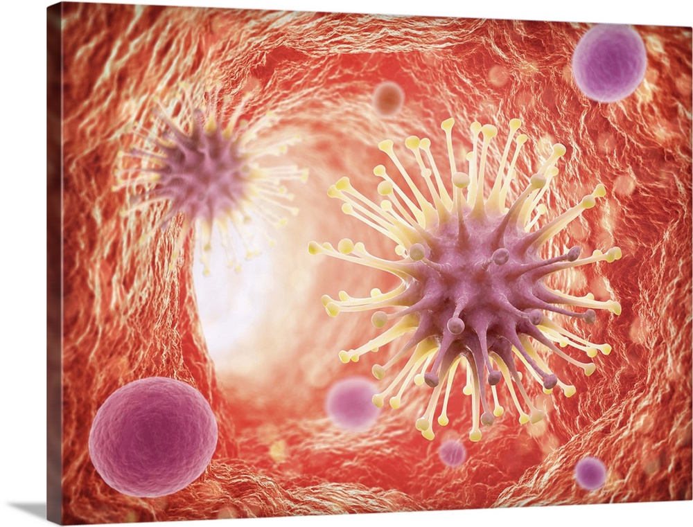 Viral infection, artwork | Great Big Canvas