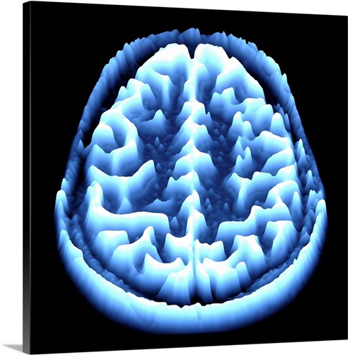 Brain Scan, MRI Scan, Heightmap | Great Big Canvas