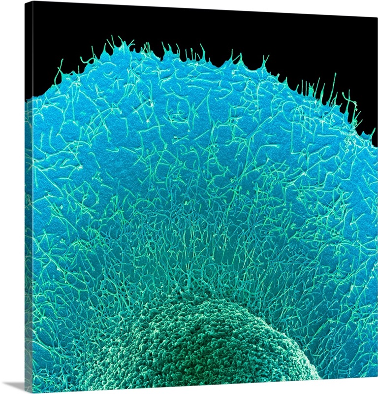Colorectal Cancer Cell, SEM | Great Big Canvas