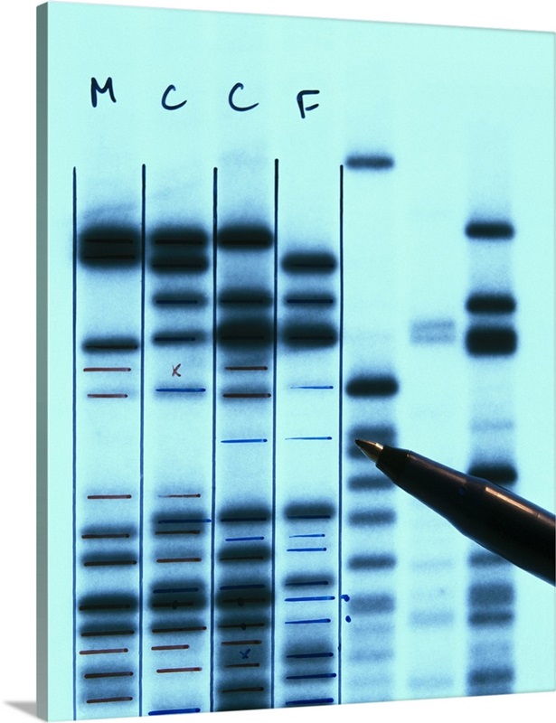DNA Fingerprinting, X-ray Autoradiograph | Great Big Canvas