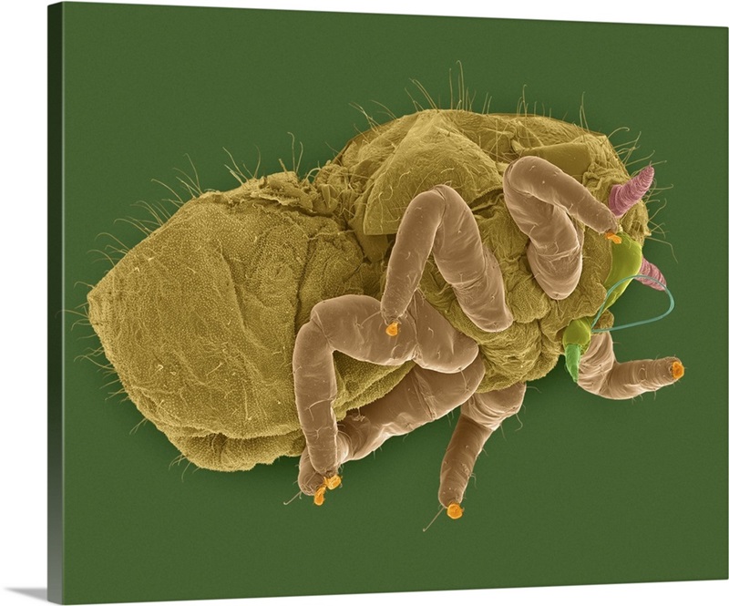 Gall-Forming Psyllid Nymph, SEM | Great Big Canvas