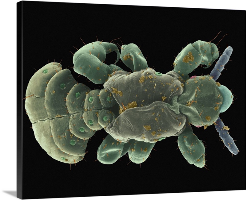 Head Louse, SEM | Great Big Canvas