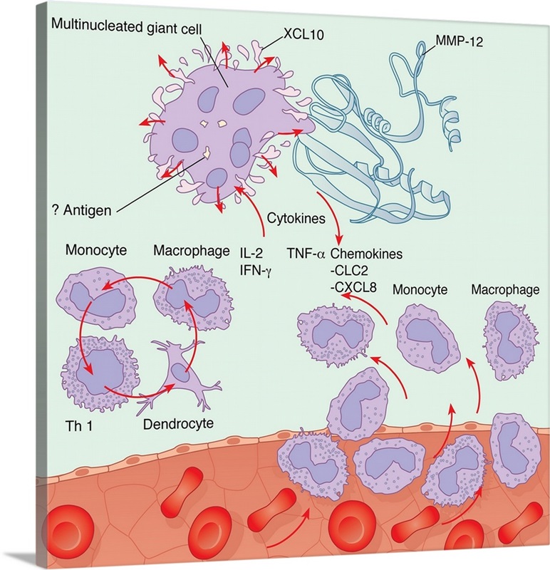 Human immune response, artwork | Great Big Canvas
