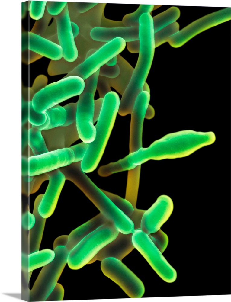 Listeria Monocytogenes, Bacterium, SEM Wall Art, Canvas Prints, Framed ...