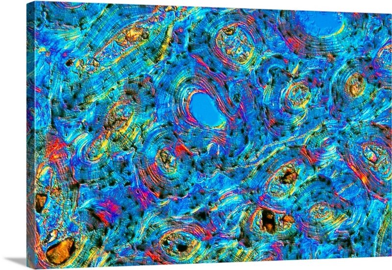 LM Of Human Compact Bone | Great Big Canvas