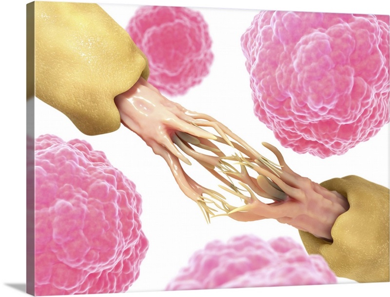 Nerve damage and stem cells, artwork | Great Big Canvas