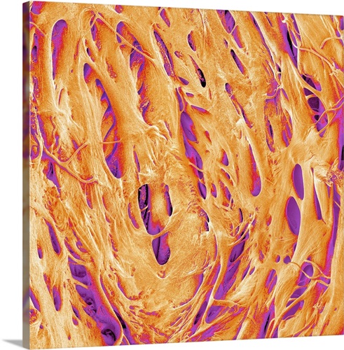 Trabeculae carneae in the heart, SEM Wall Art, Canvas Prints, Framed ...