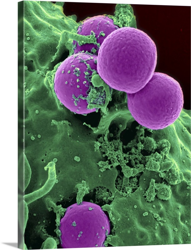 Scanning electron micrograph of a human neutrophil ingesting MRSA ...